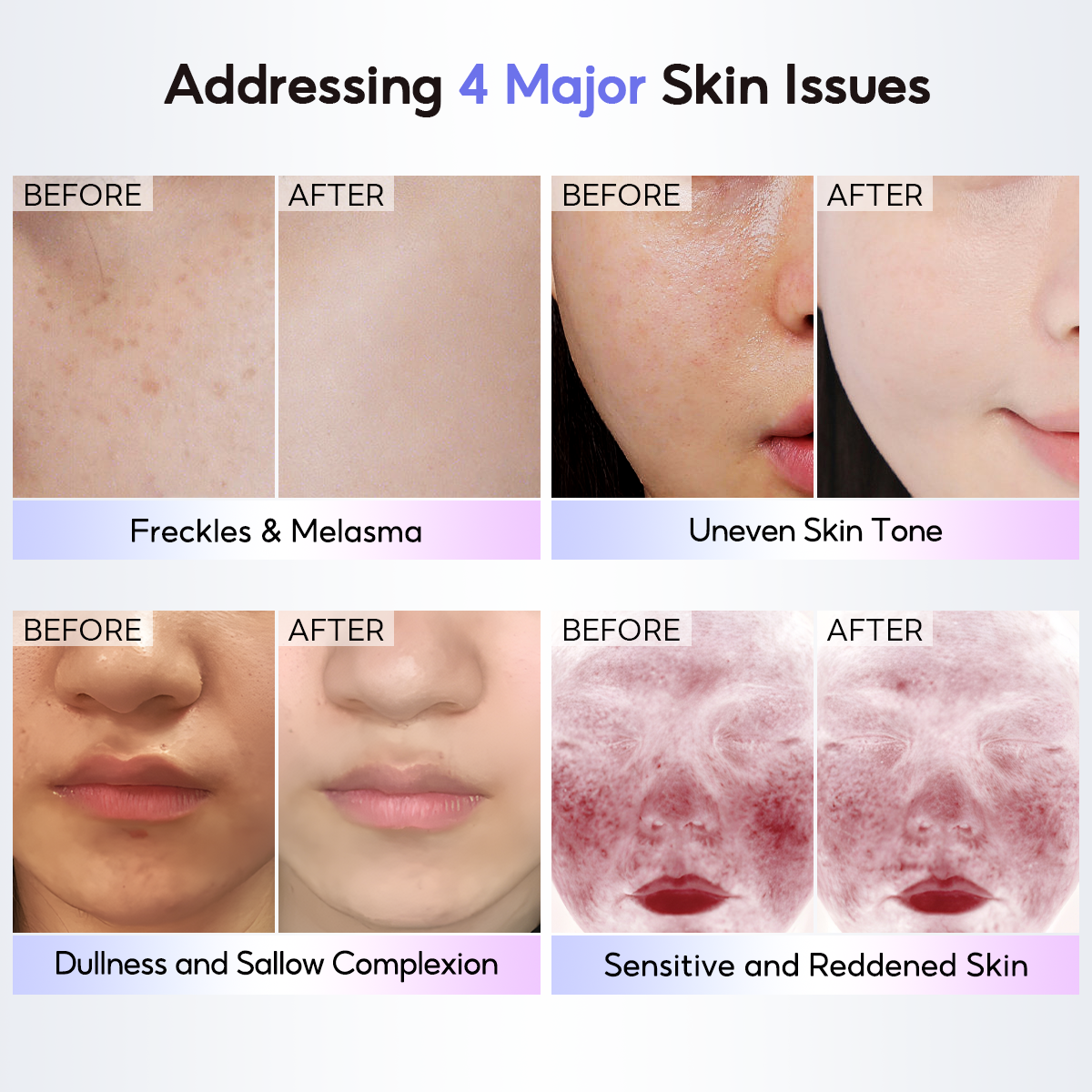 PAPA FEEL 577 DARK SPOT BRIGHTENING CREAM 30g - PAPAFEEL